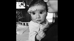 Happy Homecoming Baby Ivy! – Texas Children's Hospital